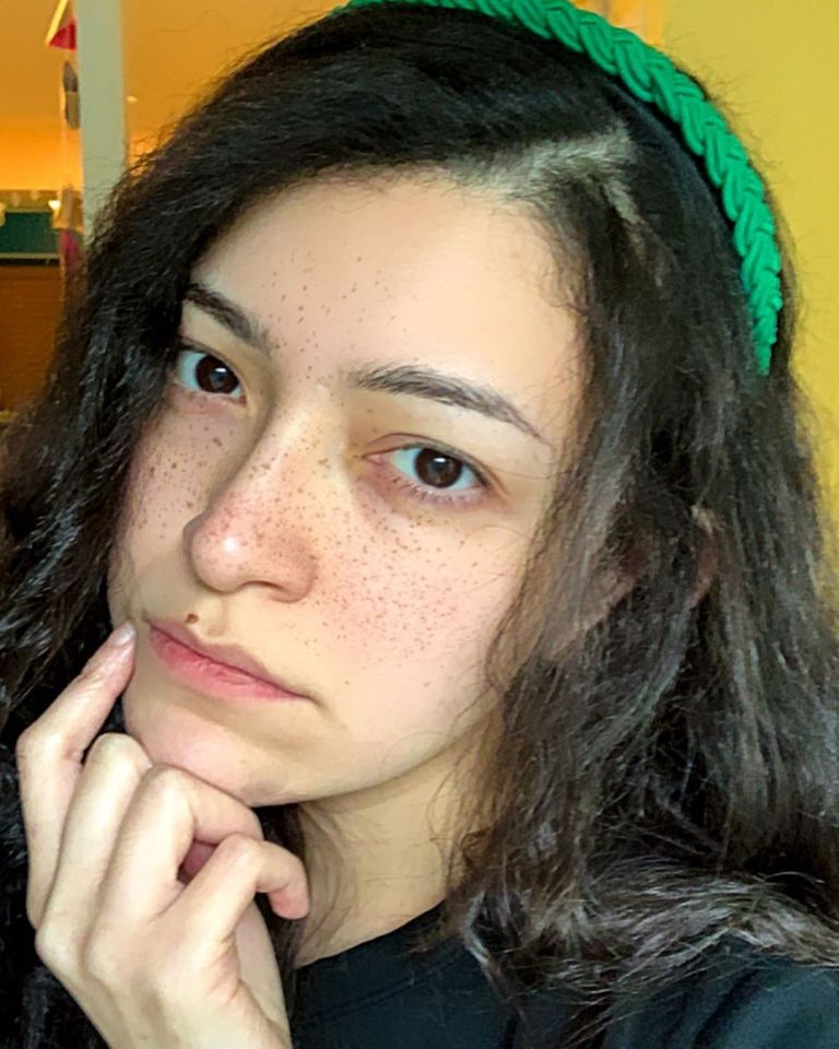 UPDATED: 40+ Fresh Faux Freckles (August 2020)